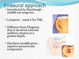 Surgical anatomy of tmj & its approaches | PPT