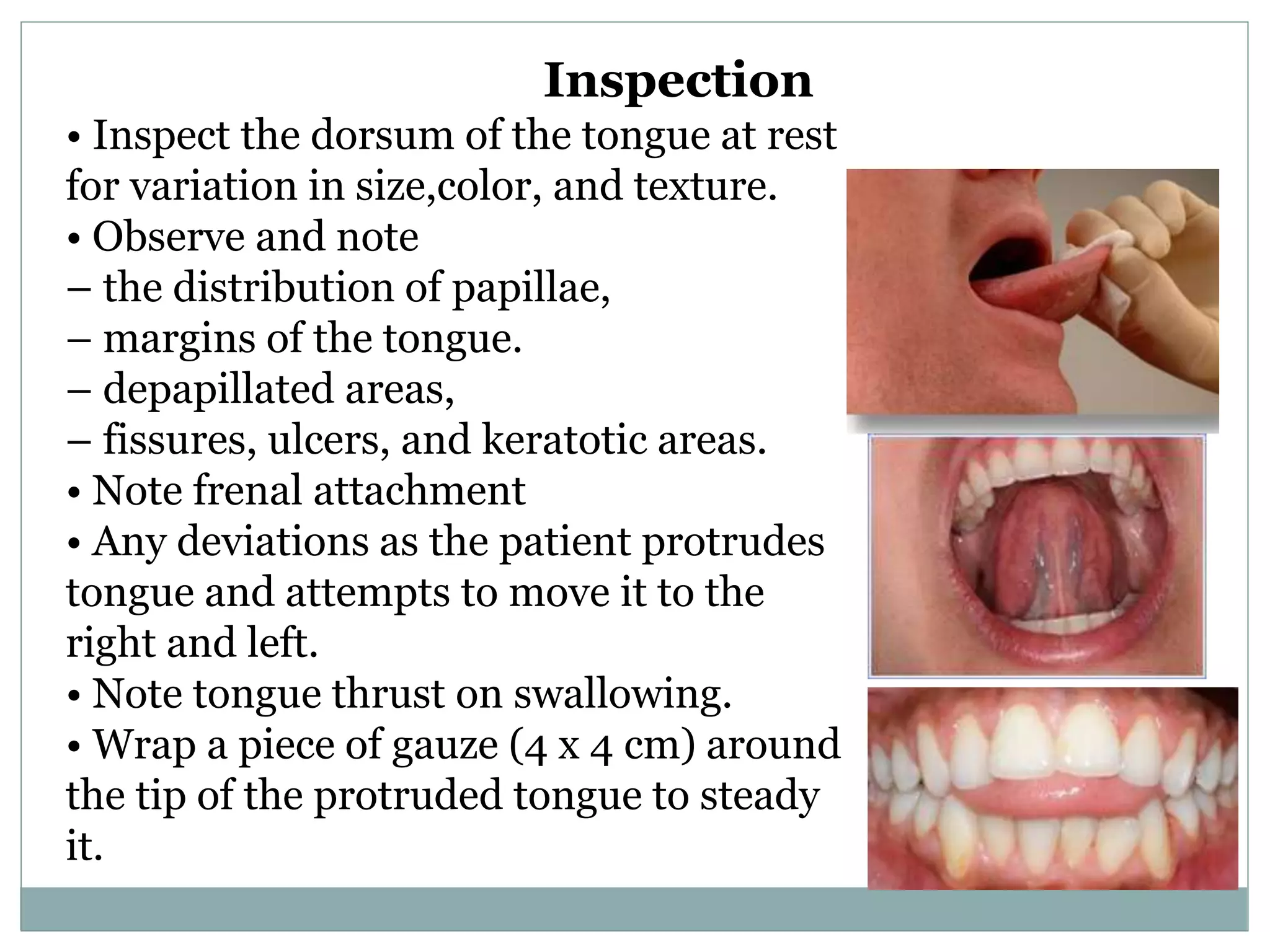 Surgical anatomy of tongue | PPTX