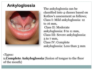 Surgical anatomy of tongue | PPT