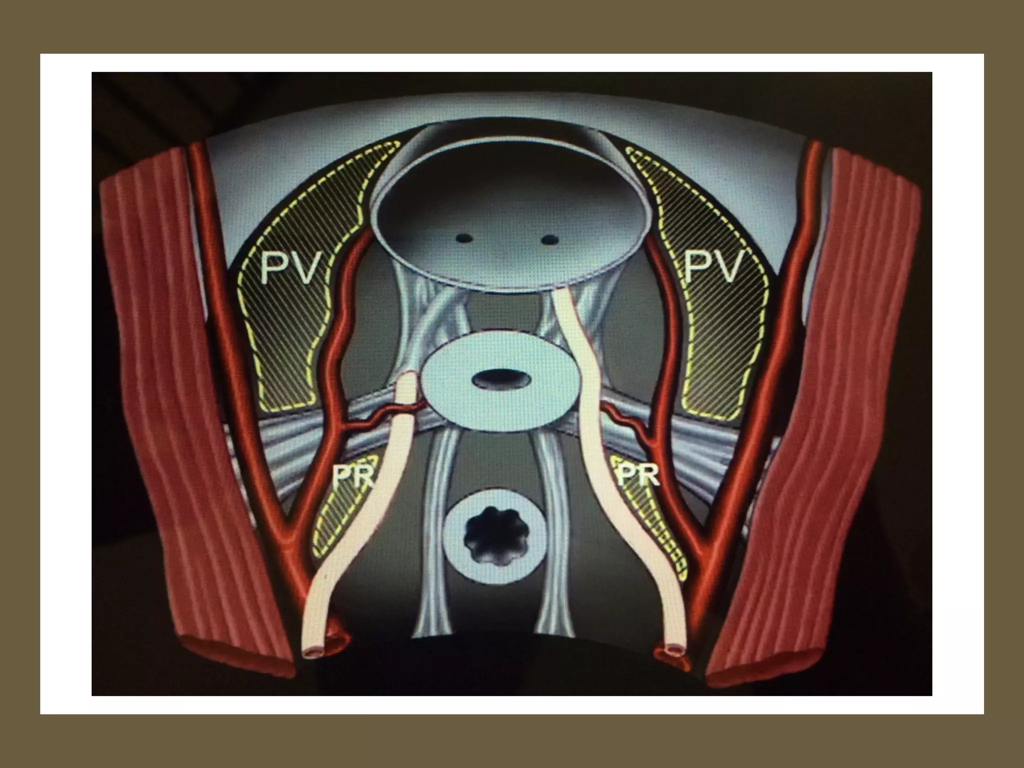 Surgical anatomy or anatomical surgery | PDF