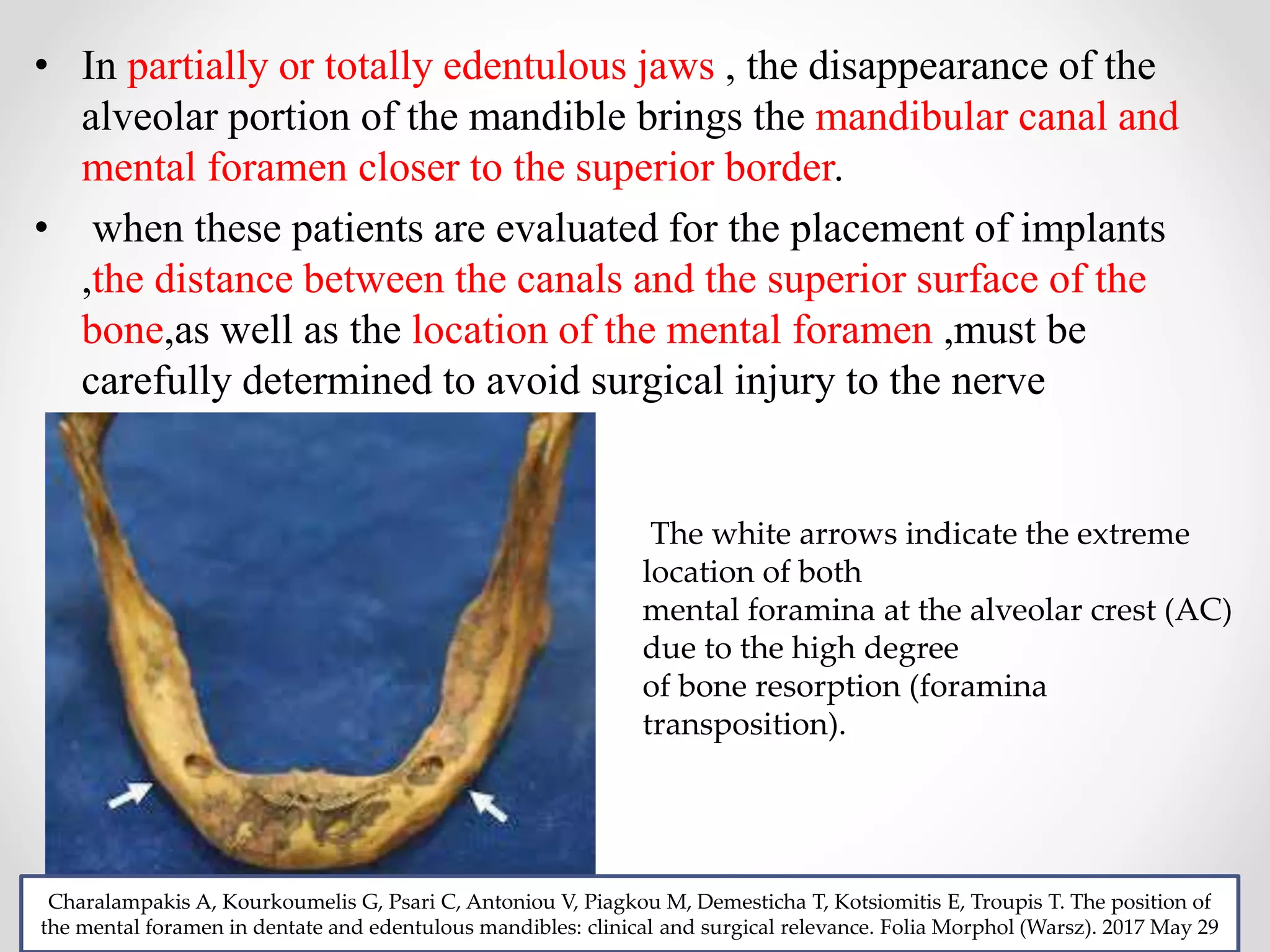IMPORTANT ANATOMICAL CONSIDERATIONS IN PERIODONTAL SURGERY AND IMPLANTS ...