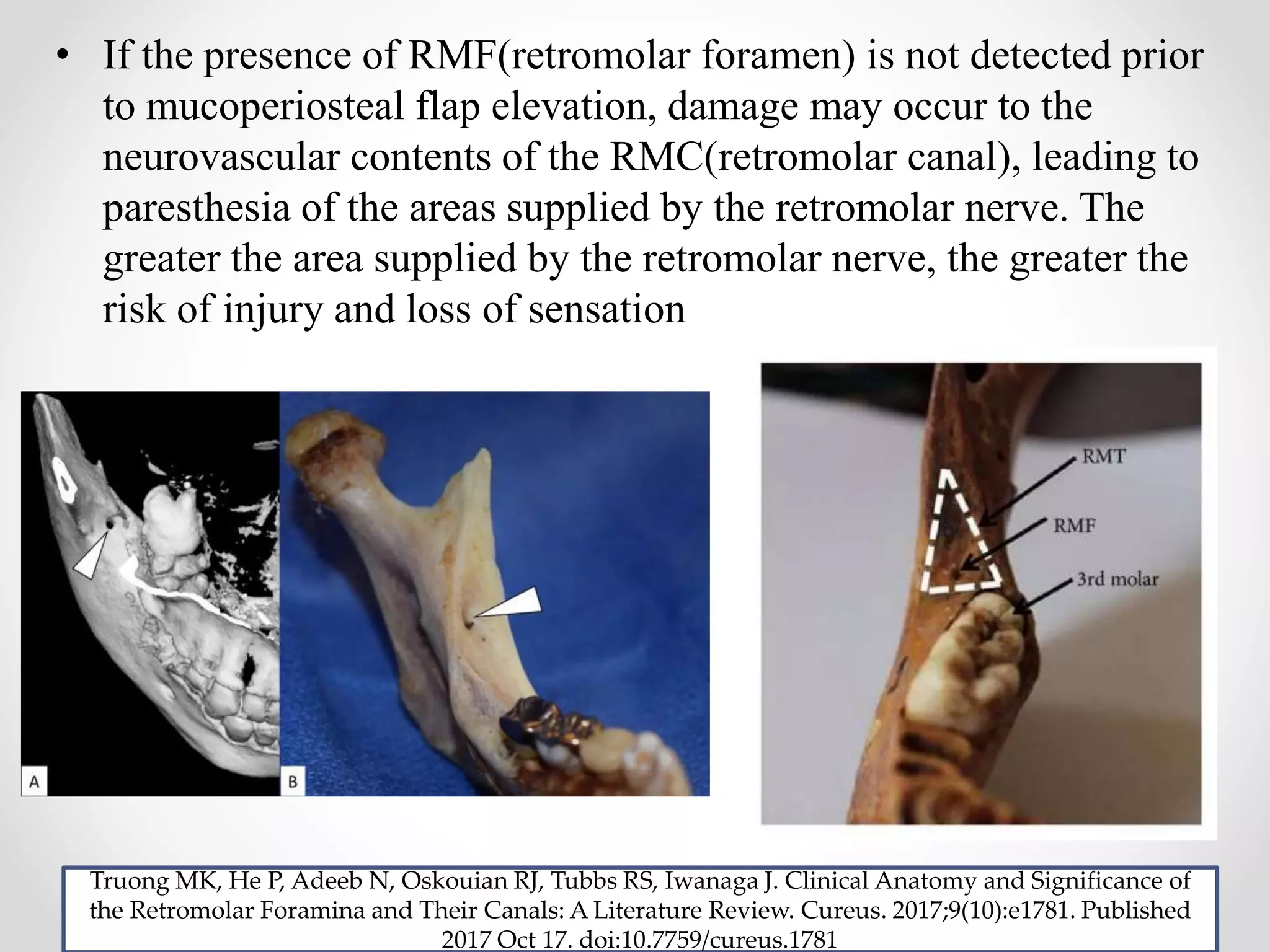 IMPORTANT ANATOMICAL CONSIDERATIONS IN PERIODONTAL SURGERY AND IMPLANTS ...