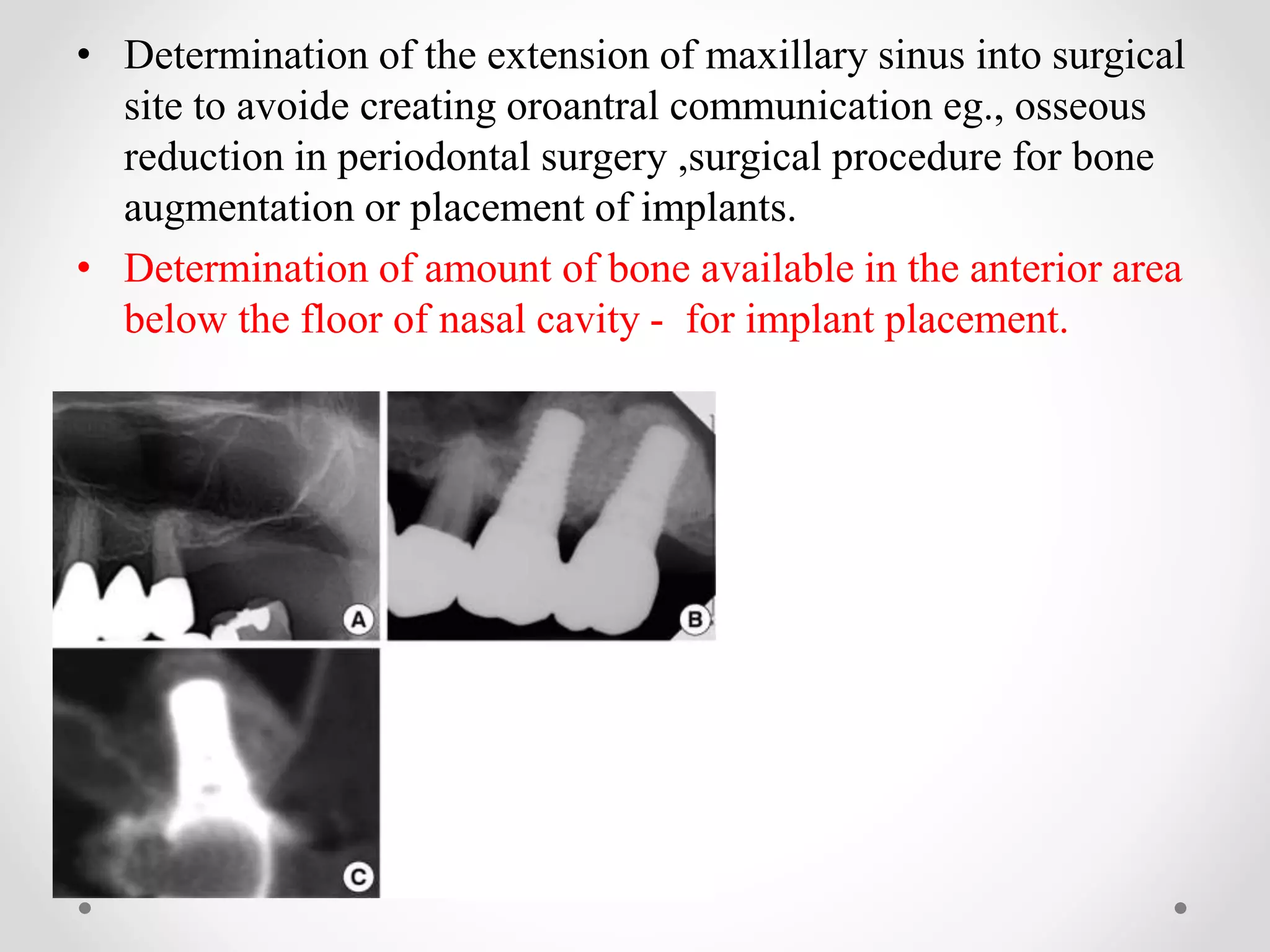 IMPORTANT ANATOMICAL CONSIDERATIONS IN PERIODONTAL SURGERY AND IMPLANTS ...