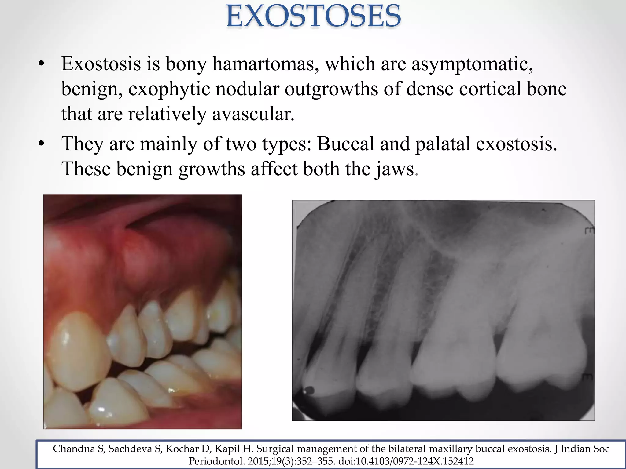 IMPORTANT ANATOMICAL CONSIDERATIONS IN PERIODONTAL SURGERY AND IMPLANTS ...