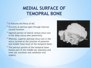 Surgical anat Temporal bone in detail... | PPTX