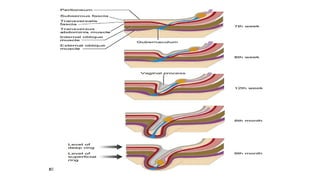 SURGICAL AND APPLIED ANATOMY OF THE INGUINAL CANAL BK.ppt