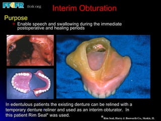 Surgical and interim obturation | PPT