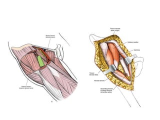 Surgical approach around hip and knee | PPTX