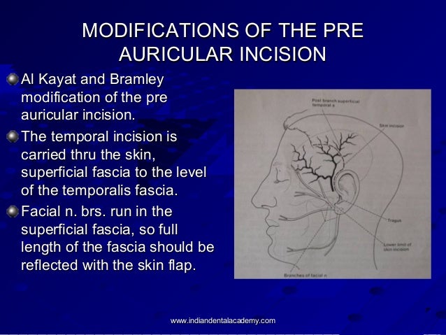 Surgical approaches of TMJ /certified fixed orthodontic courses by