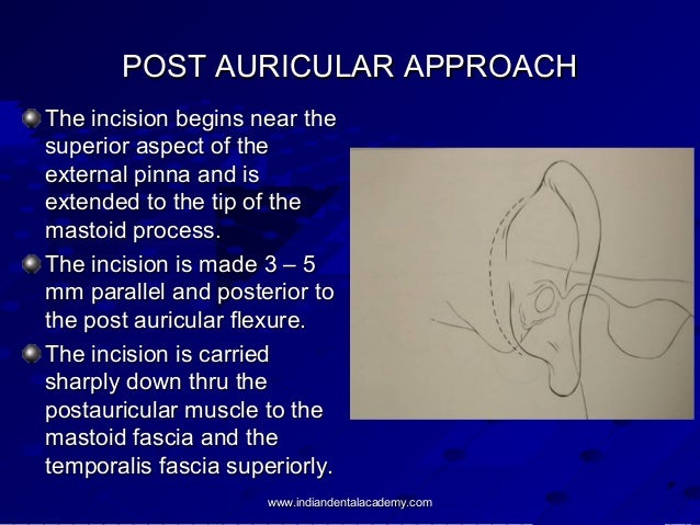 Surgical approaches of TMJ /certified fixed orthodontic courses by
