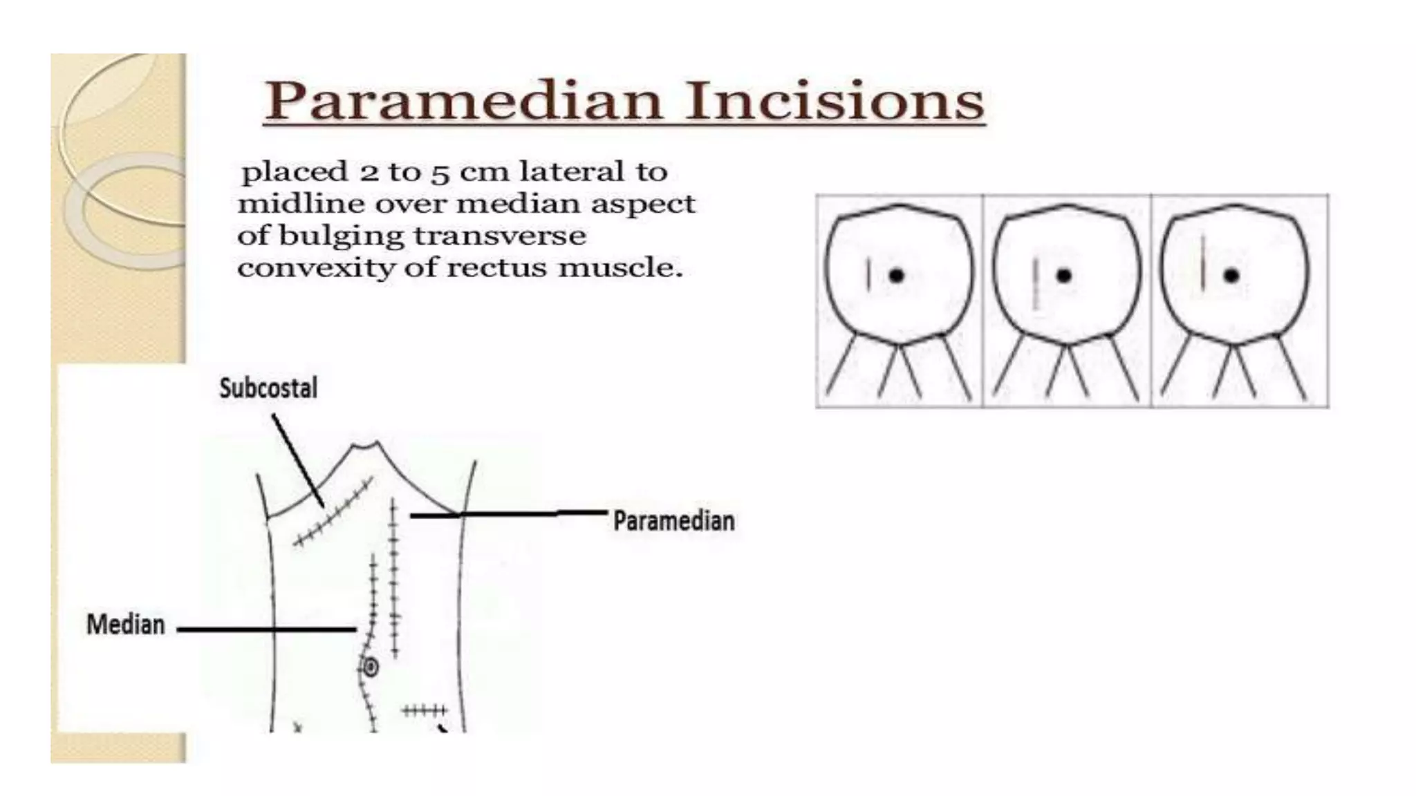 SURGICAL APPROACHES,INCISIONS AND USE OF APPROPRIATE.pptx