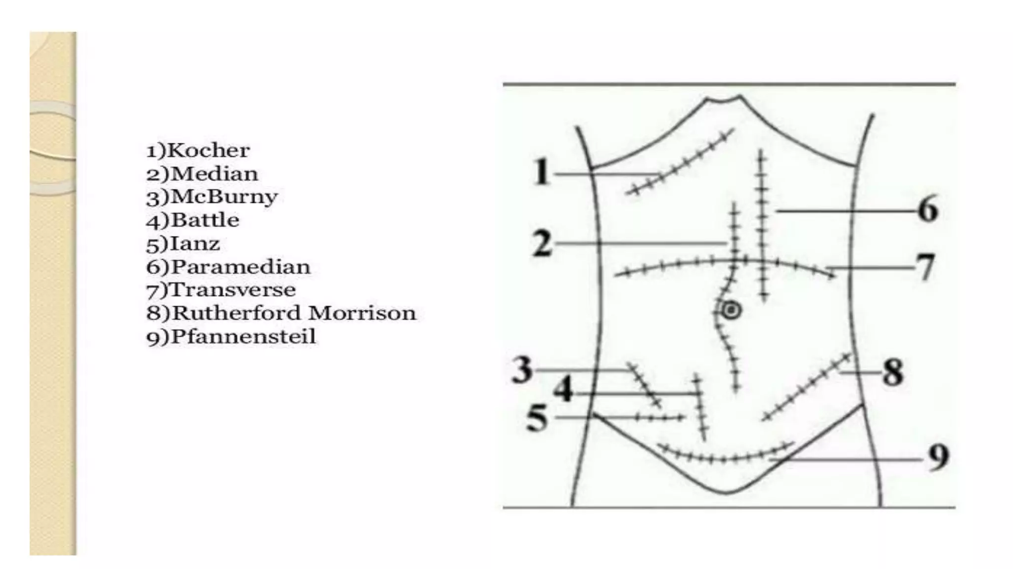 SURGICAL APPROACHES,INCISIONS AND USE OF APPROPRIATE.pptx