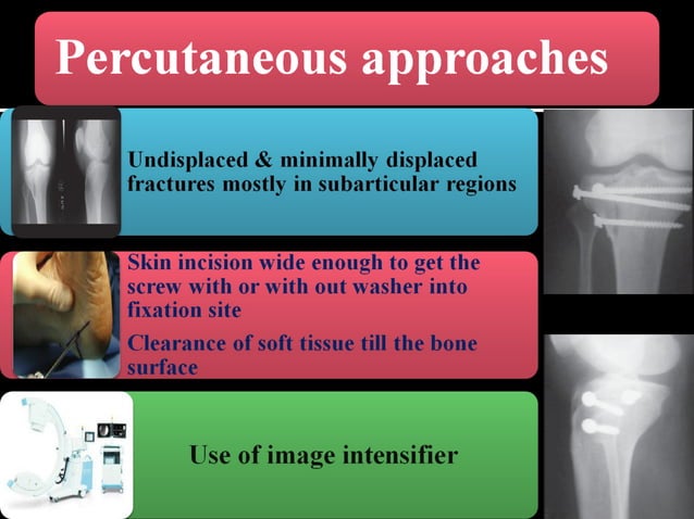 Surgical approaches in orthopaedics- General principles | PPT ...
