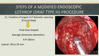 SURGICAL APPROACHES TO FRONTAL SINUS AND FRONTAL RECESS | PPTX