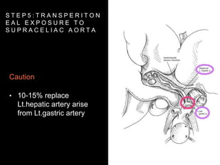 Surgical approaches to abdominal vessels | PPTX