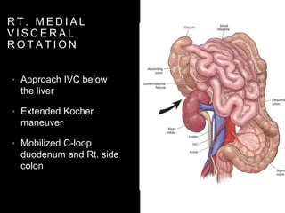 Surgical approaches to abdominal vessels | PPTX