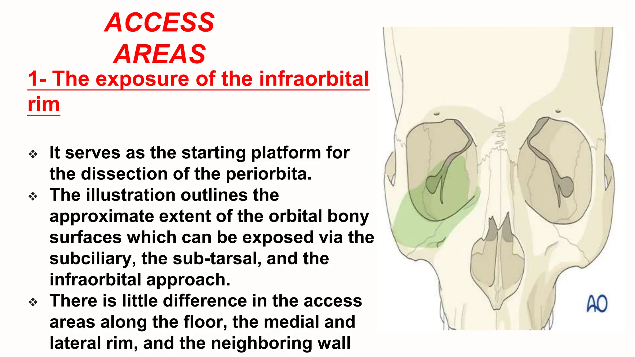 surgical approaches to facial skeleton -periorbital.pptx
