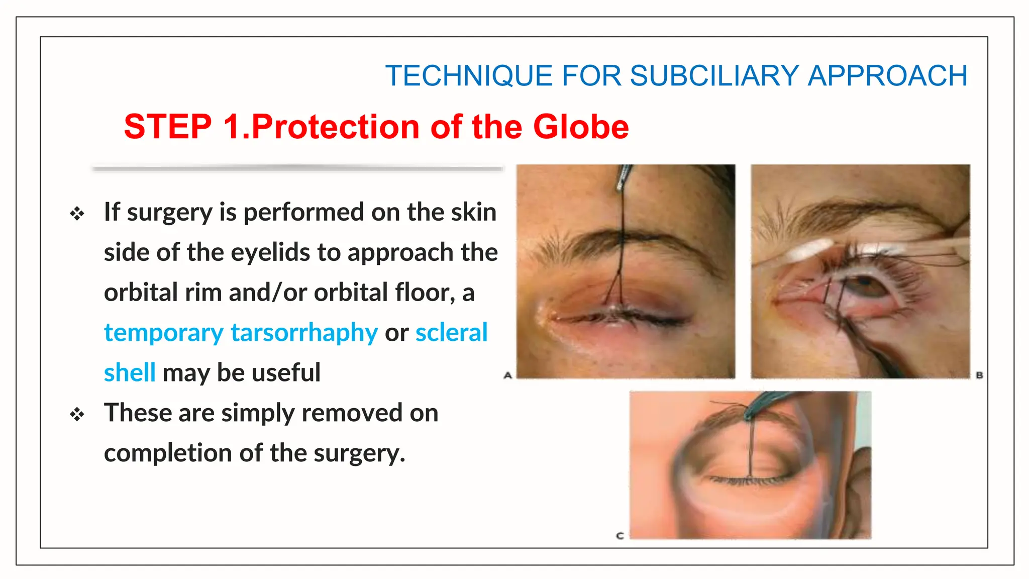 surgical approaches to facial skeleton -periorbital.pptx