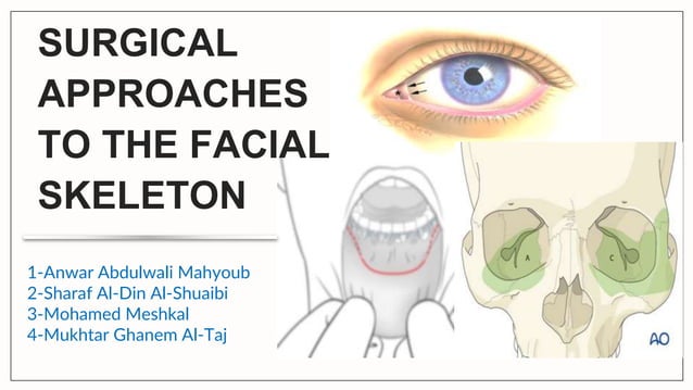 surgical approaches to facial skeleton -periorbital.pptx | Eye and ...