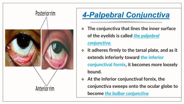 surgical approaches to facial skeleton -periorbital.pptx | Eye and ...