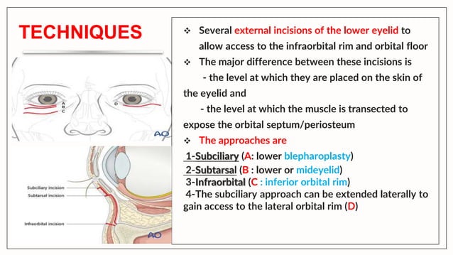 surgical approaches to facial skeleton -periorbital.pptx | Eye and ...