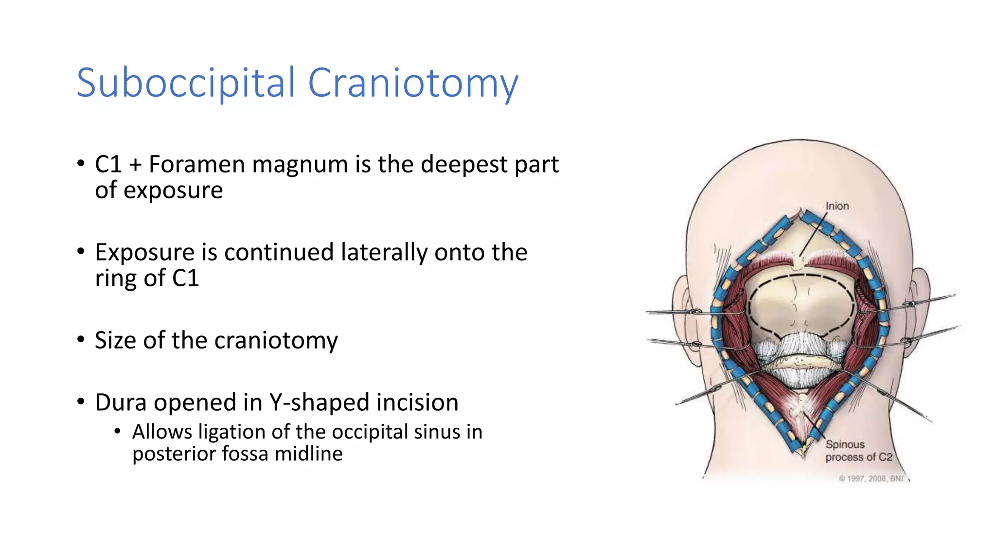 Surgical approaches to the CCJ.pptx