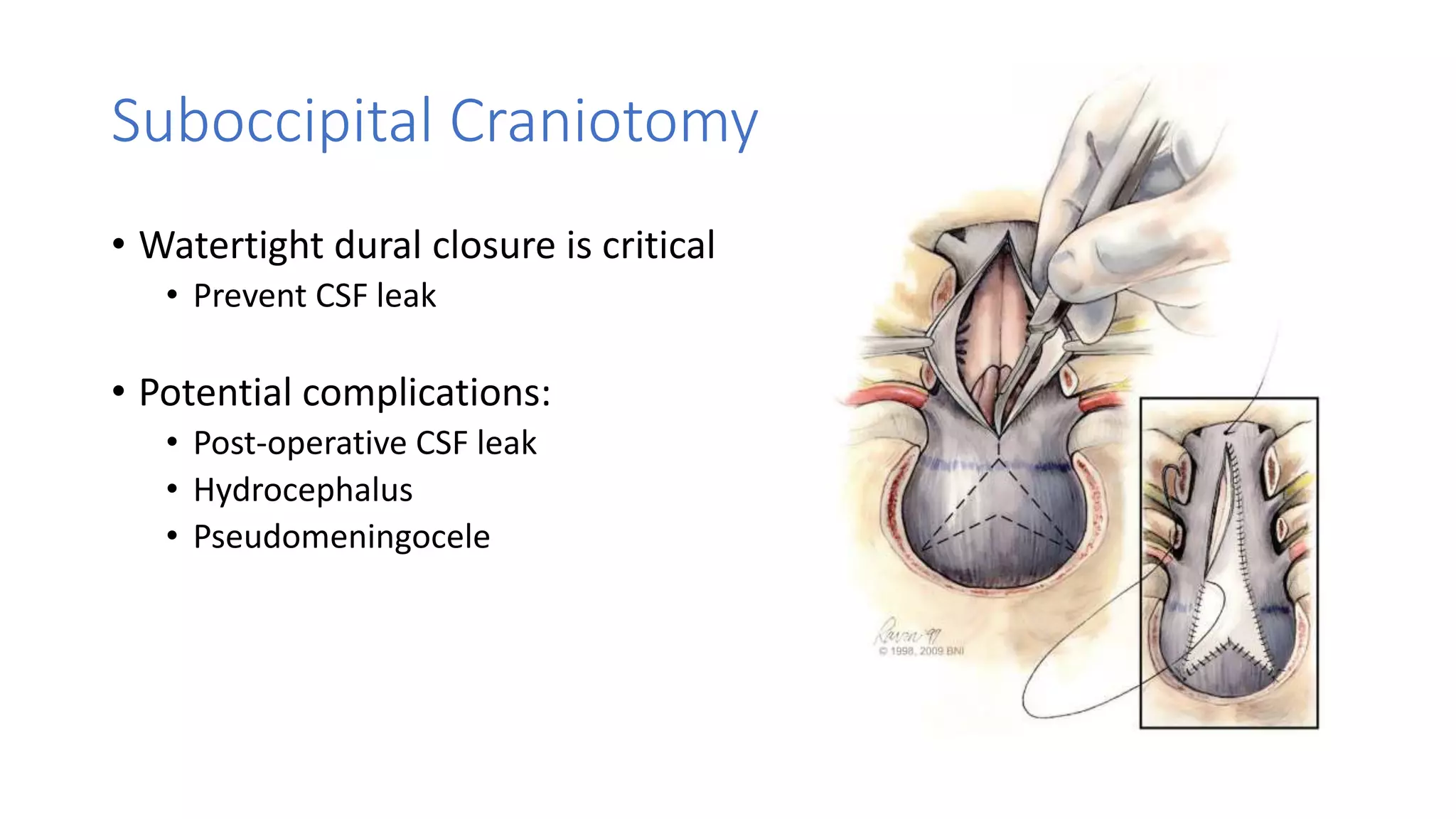 Surgical approaches to the CCJ.pptx