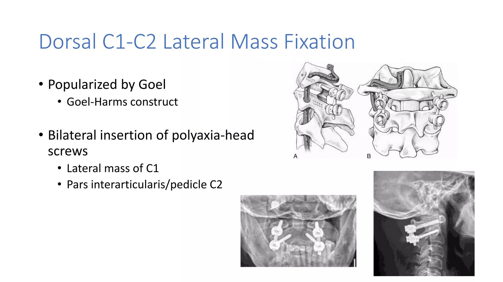 Surgical approaches to the CCJ.pptx