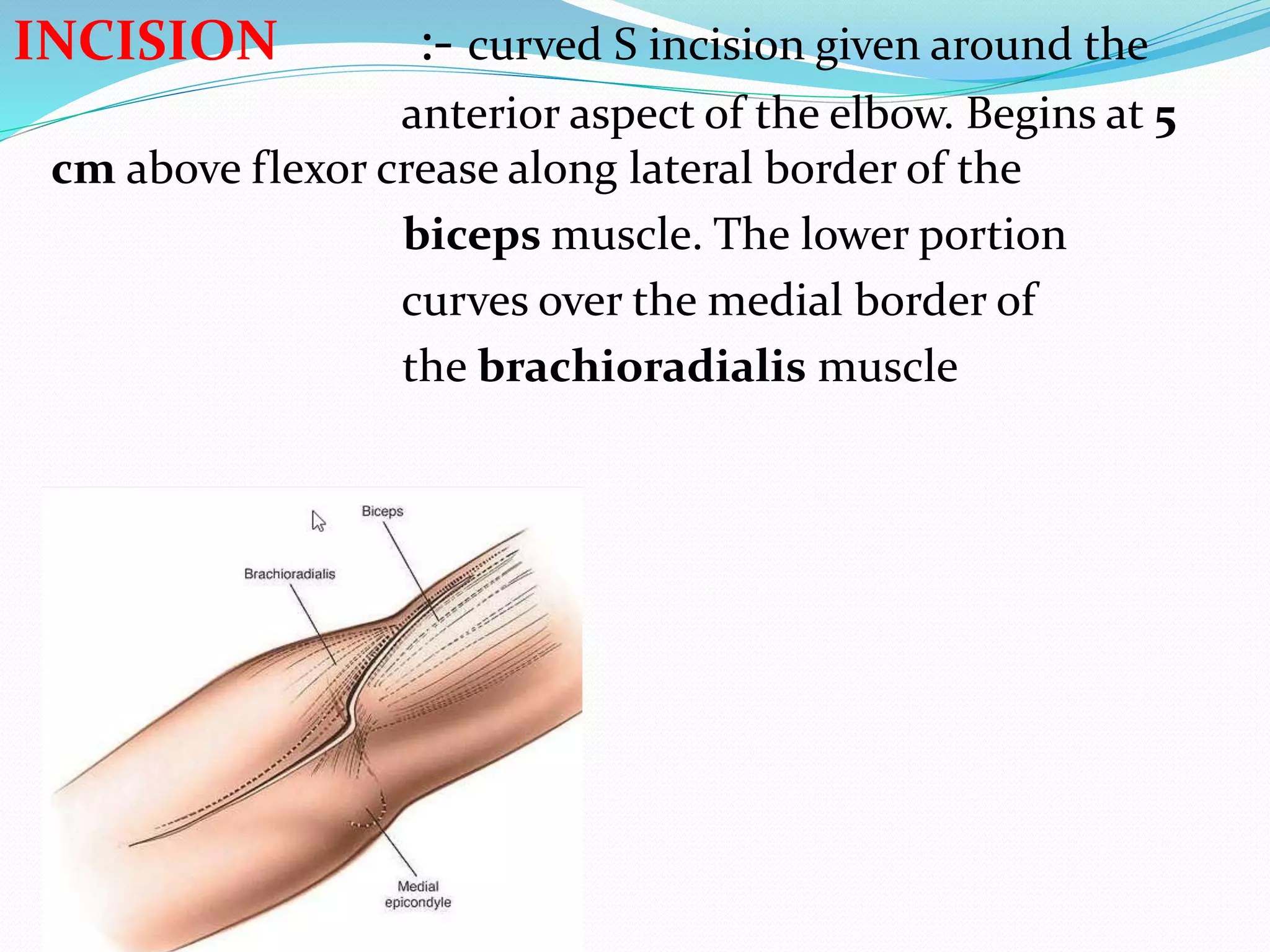 Surgical approaches to the elbow | PPTX