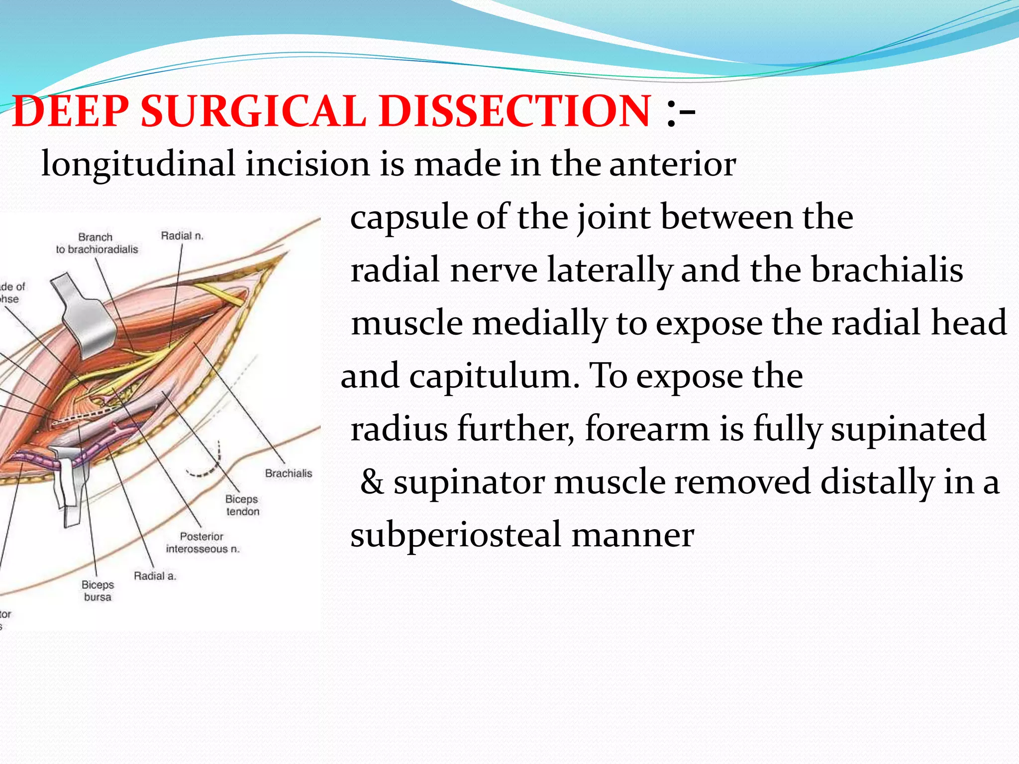Surgical approaches to the elbow | PPTX