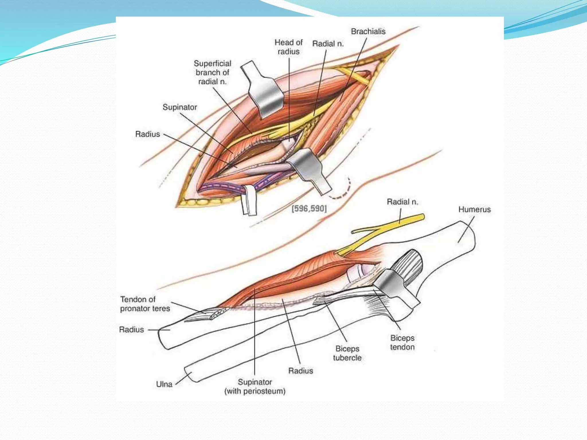 Surgical approaches to the elbow | PPTX