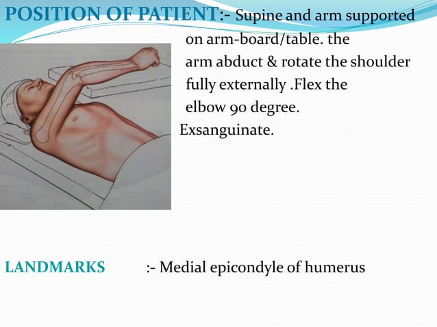 Surgical approaches to the elbow | PPTX | Death, Injury, or Military ...