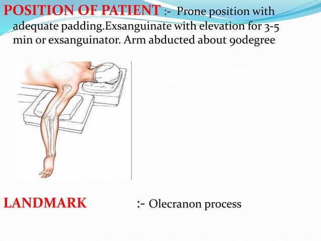Surgical approaches to the elbow | PPTX | Death, Injury, or Military ...