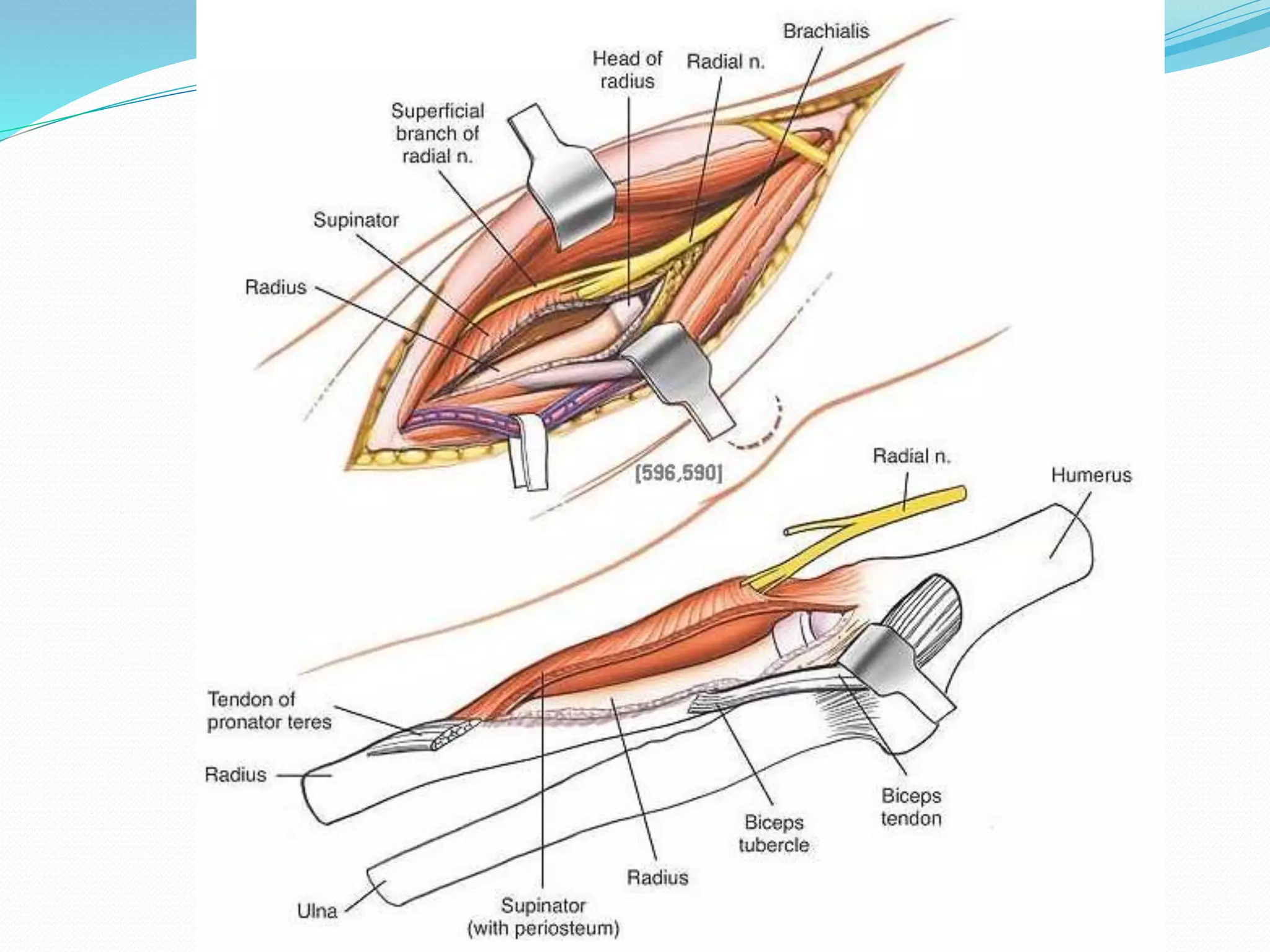 Surgical approaches to the elbow | PPTX