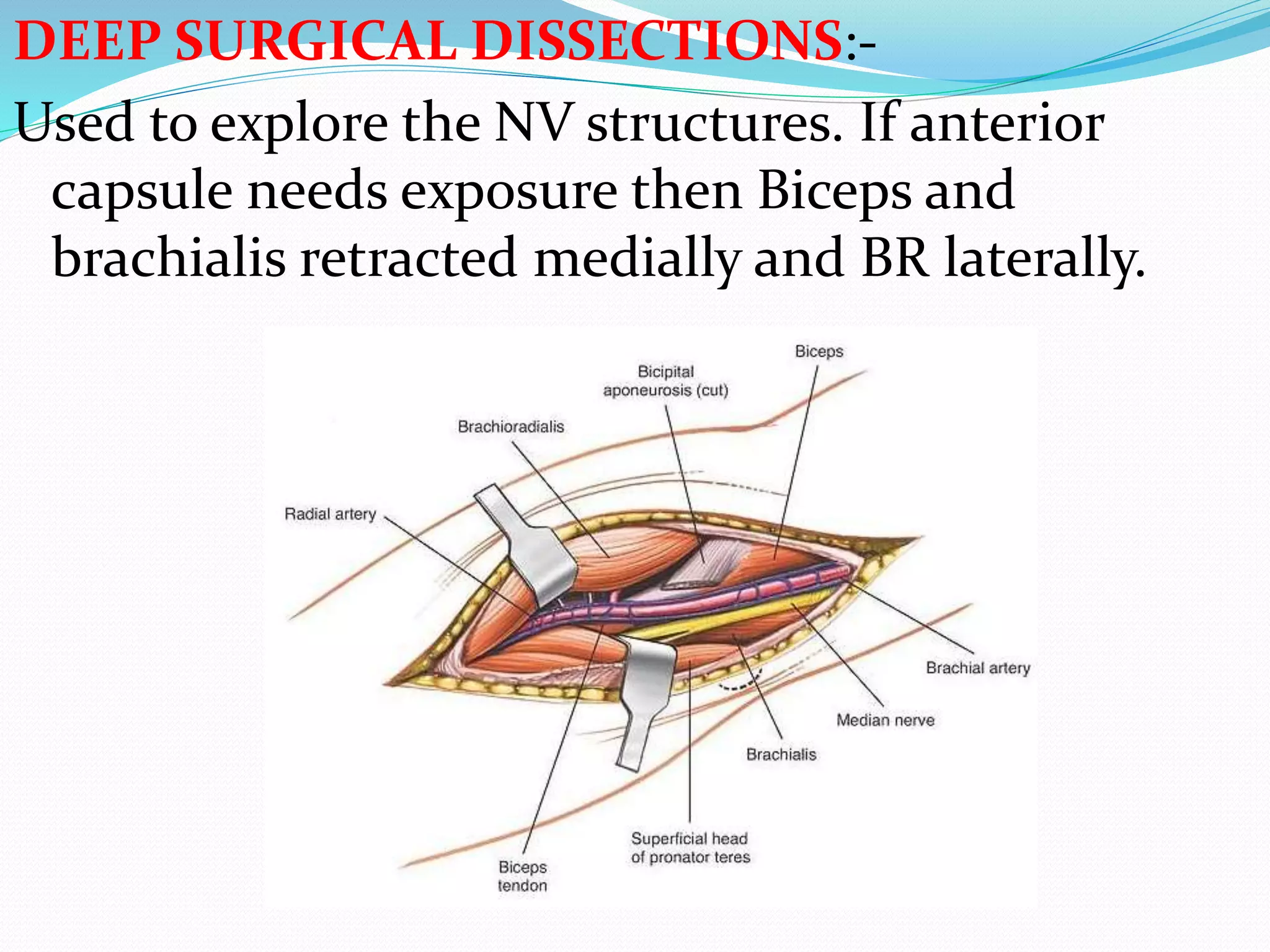 Surgical approaches to the elbow | PPTX