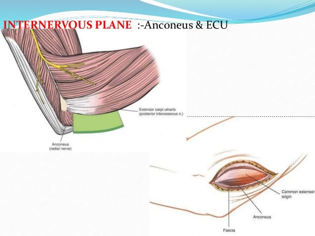 Surgical approaches to the elbow