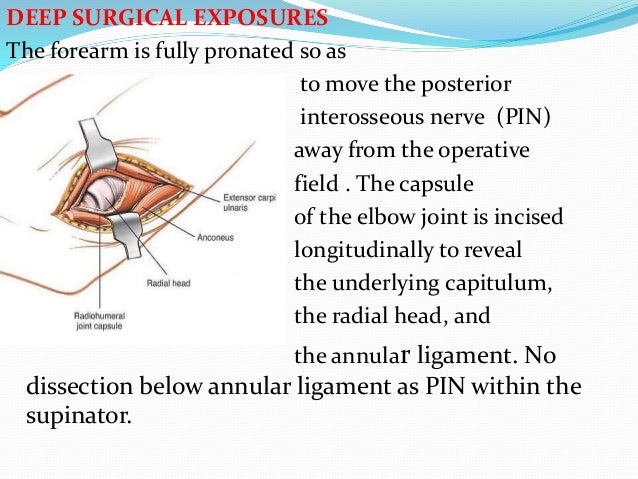 Surgical approaches to the elbow