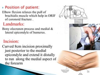 Surgical approaches to the elbow | PPTX