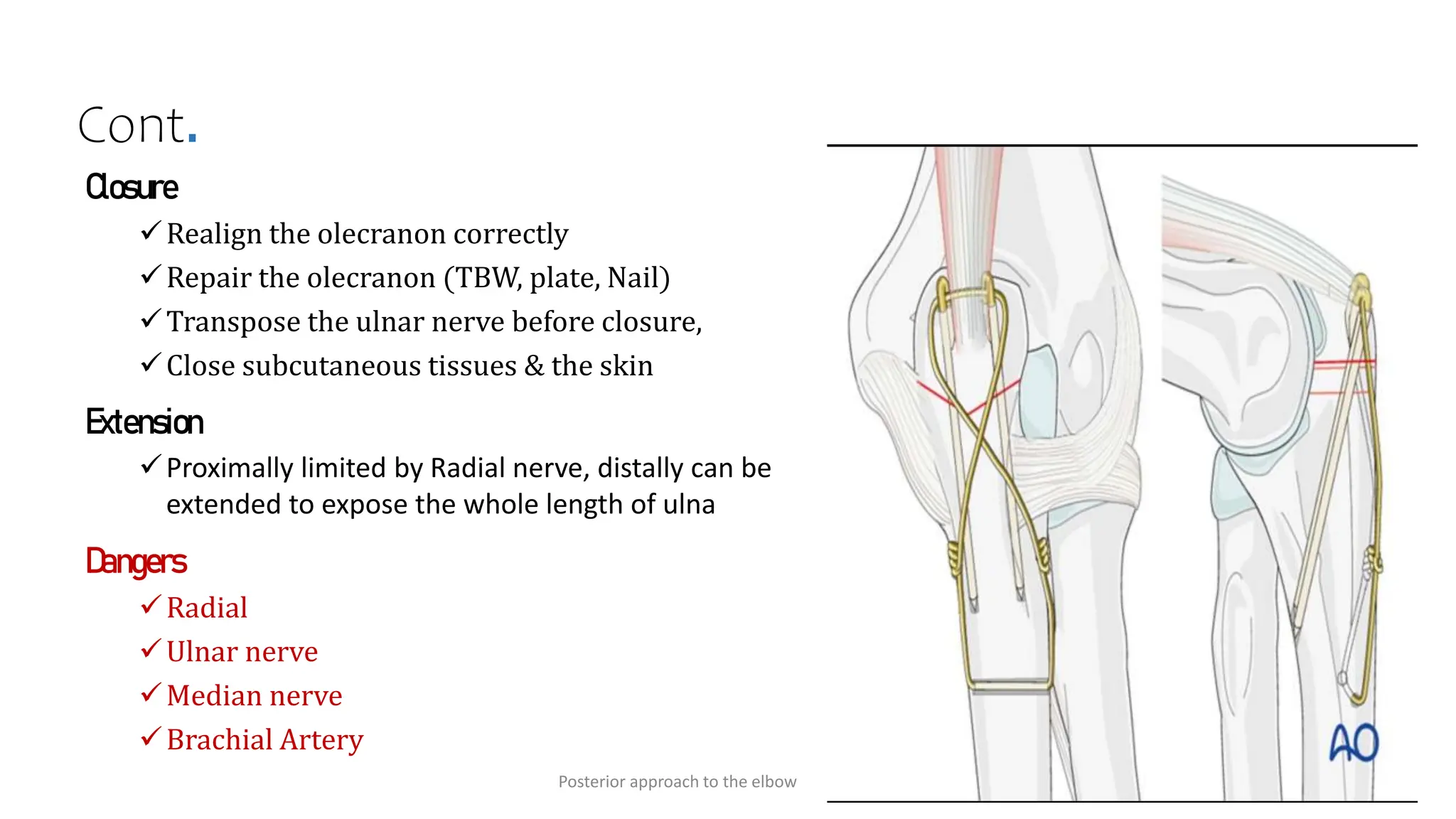 Surgical Approaches to the Elbow & Forearm.pptx