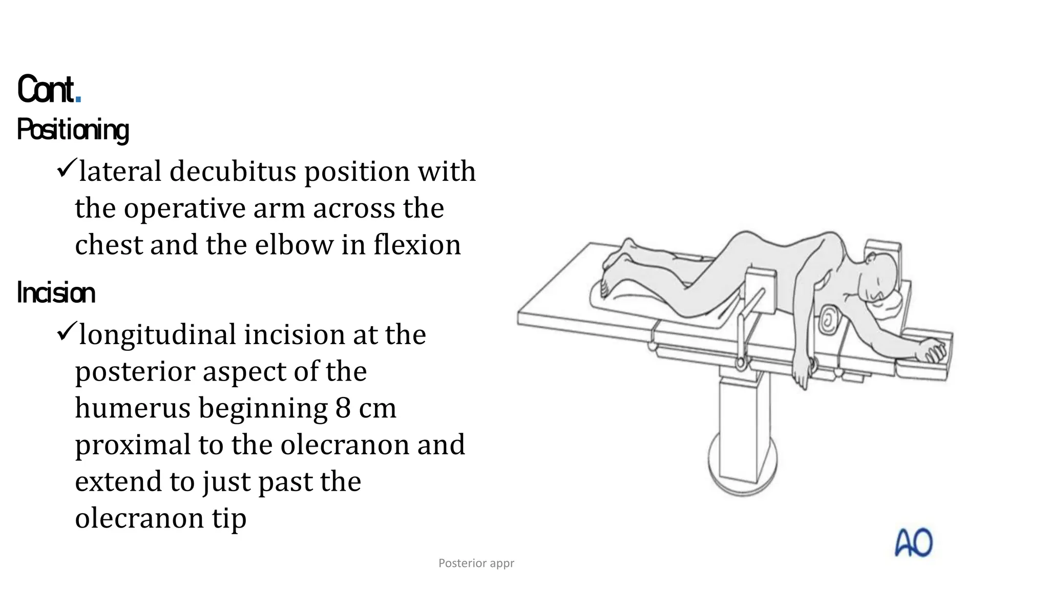 Surgical Approaches to the Elbow & Forearm.pptx