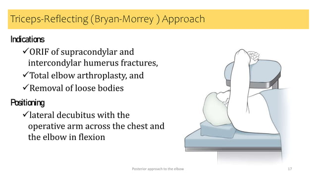 Surgical Approaches to the Elbow & Forearm.pptx