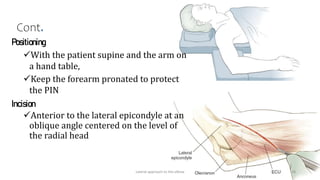 Surgical Approaches to the Elbow & Forearm.pptx