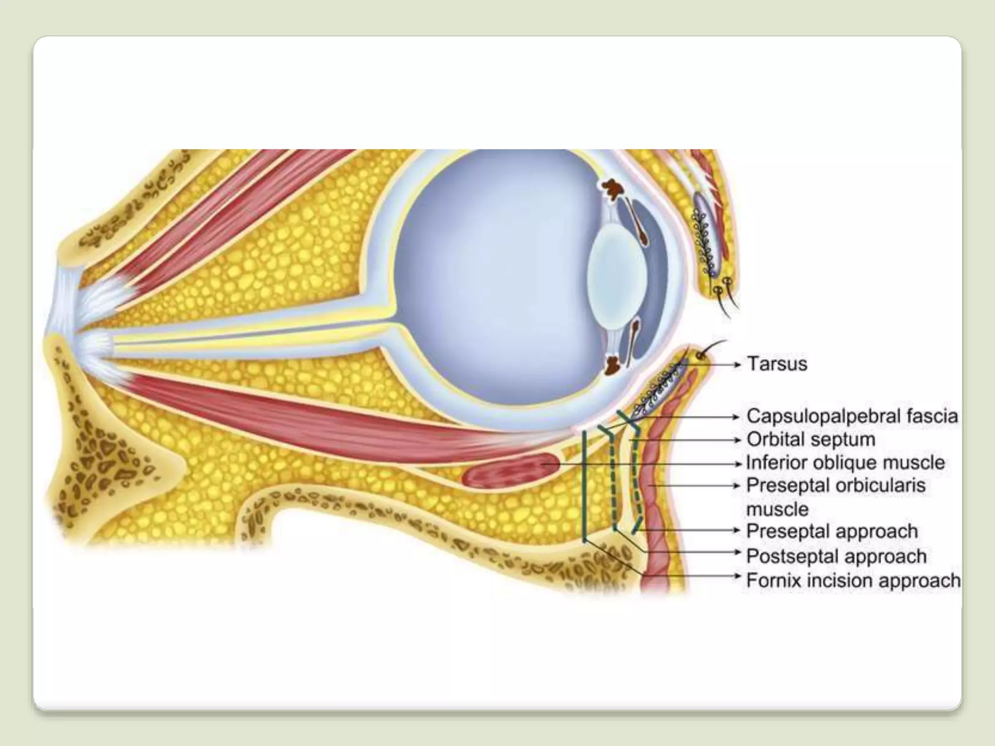 Surgical approaches to the facial skeleton | PPTX