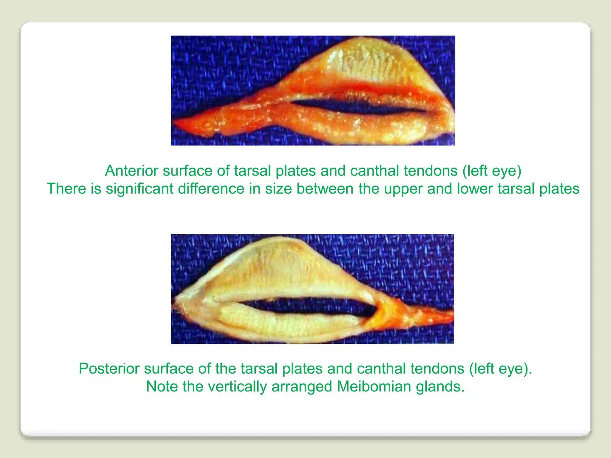Surgical approaches to the facial skeleton | PPTX