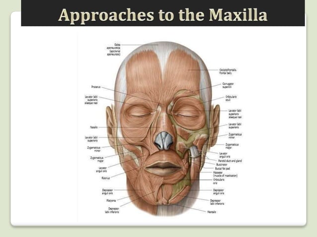 Surgical approaches to the facial skeleton | PPTX