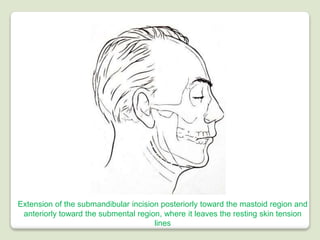 Surgical approaches to the facial skeleton | PPTX