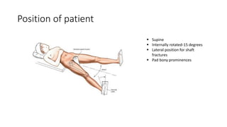 Surgical Approaches to the Femur.pptx