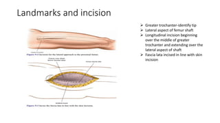 Surgical Approaches to the Femur.pptx