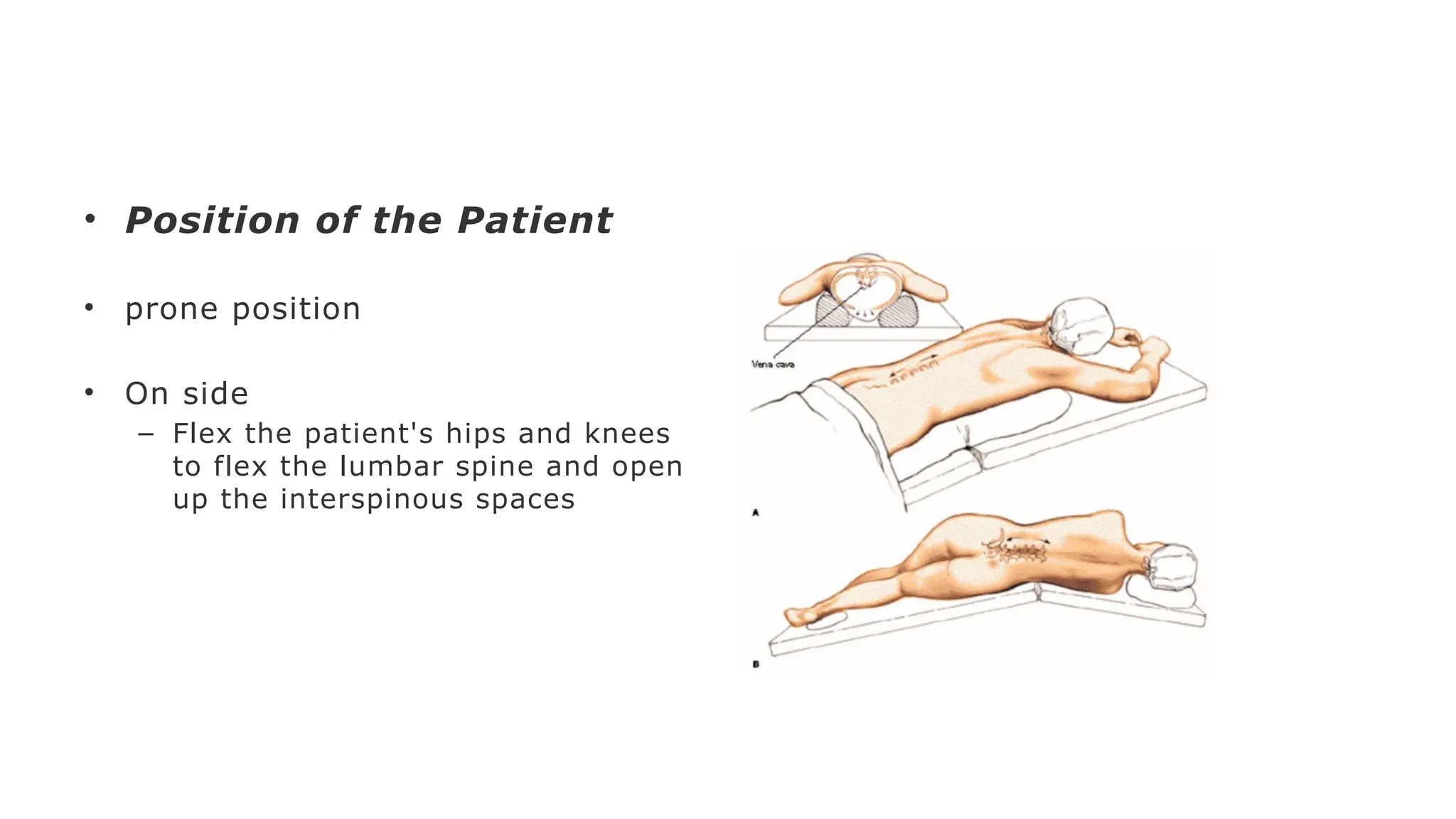 Surgical approaches to the human spine.pptx