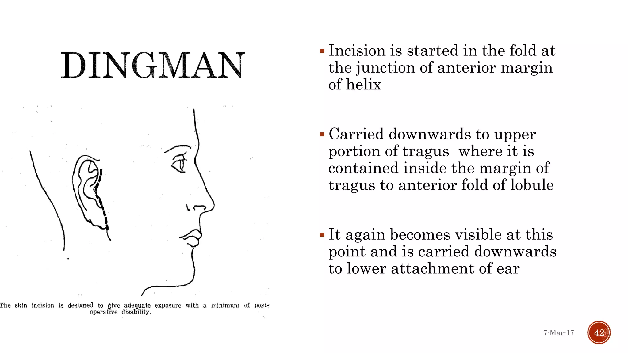 Surgical approaches to tmj | PPTX